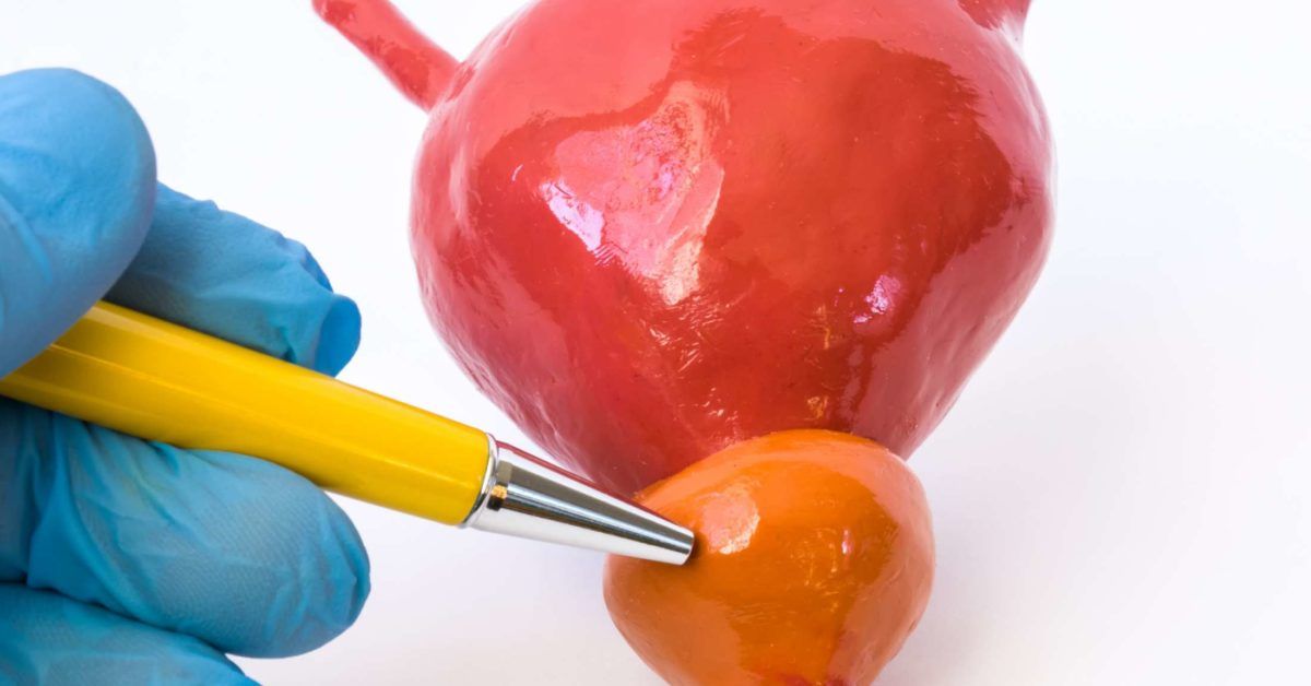 Acute prostatitis: Symptoms, treatment, and home remedies