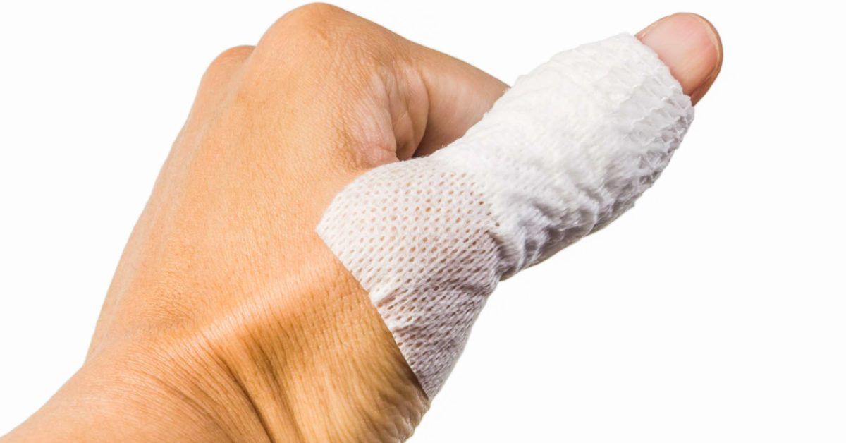 Sprained thumb: Treatment, recovery, and symptoms