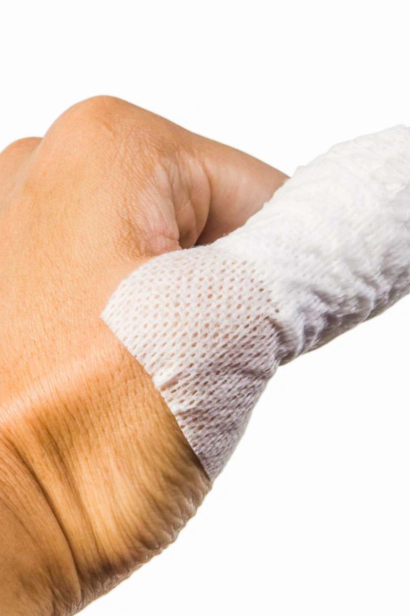 Sprained thumb: Treatment, recovery, and symptoms