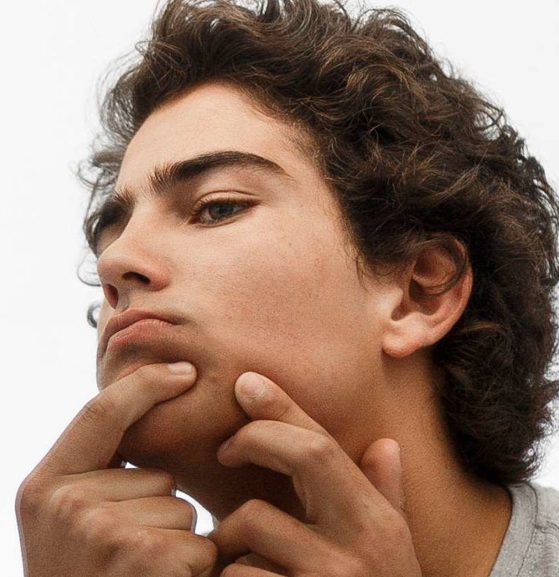 Blood-filled pimples: Causes, treatment, and types