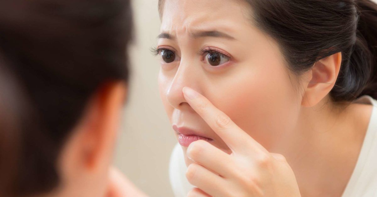 Whiteheads on the nose: How to get rid of them