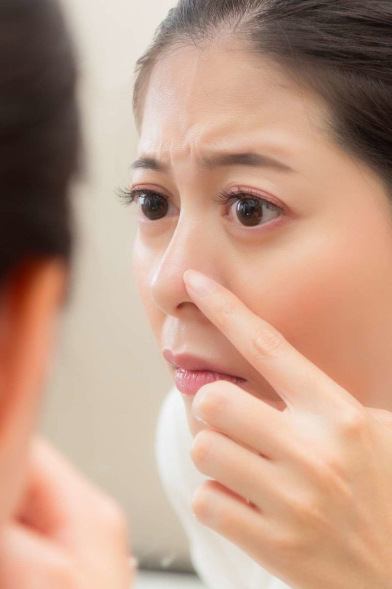 Whiteheads on the nose: How to get rid of them