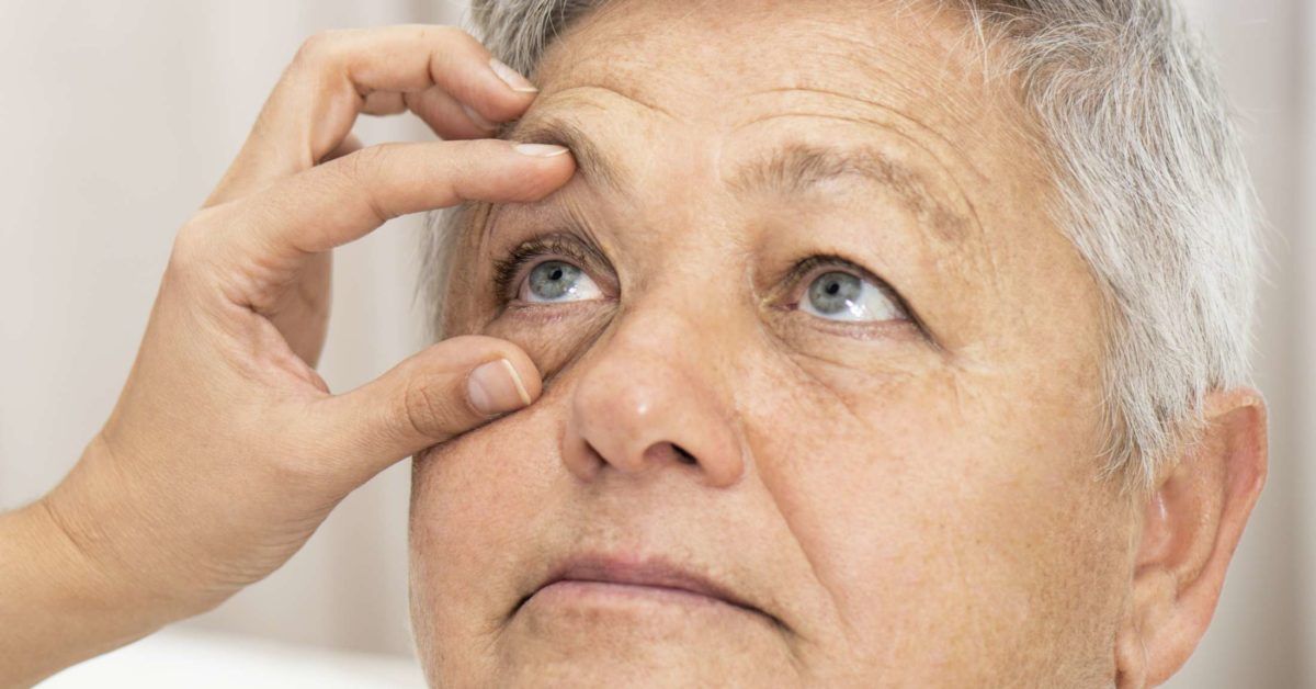 Ingrown eyelash: Causes, identification, and treatment