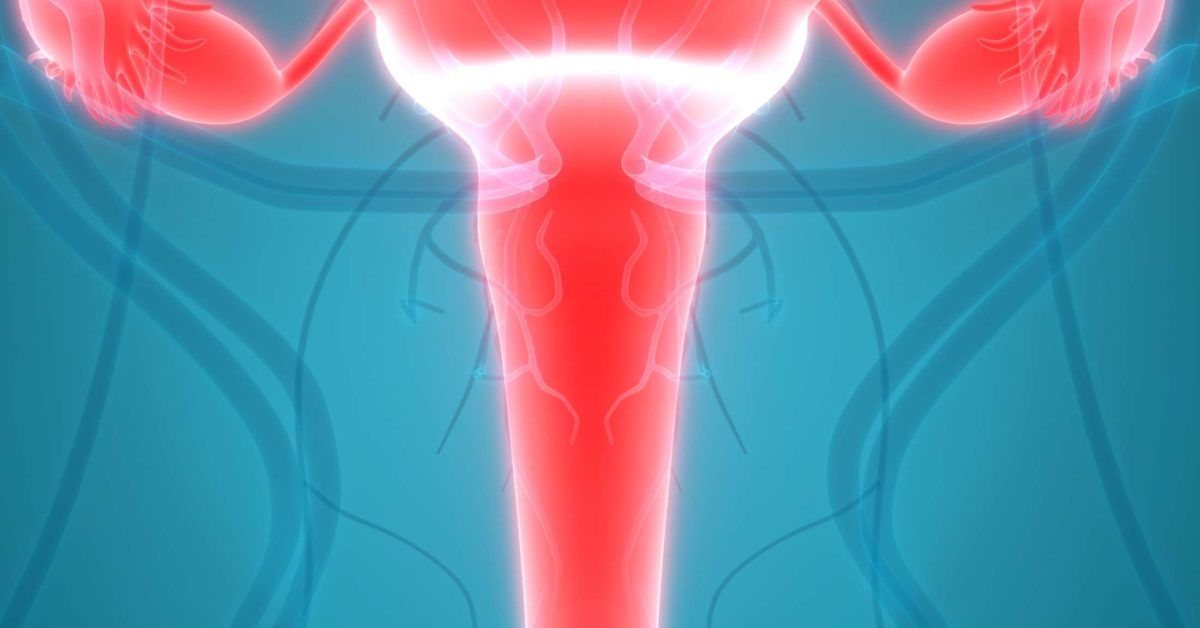 Cervicitis: Symptoms, causes, treatments, and natural remedies