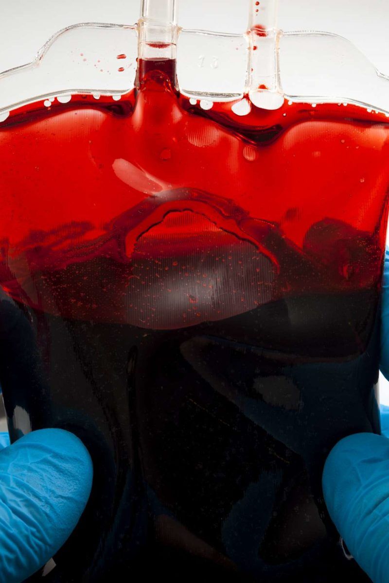 Trauma death risk higher in people with type O blood