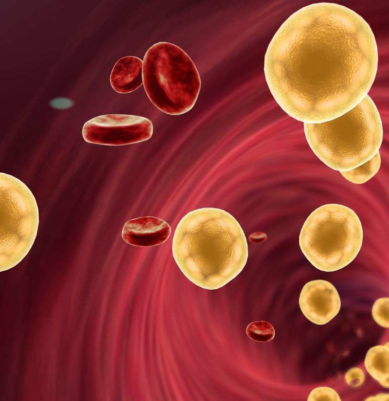 Dyslipidemia: Causes, symptoms, and treatment