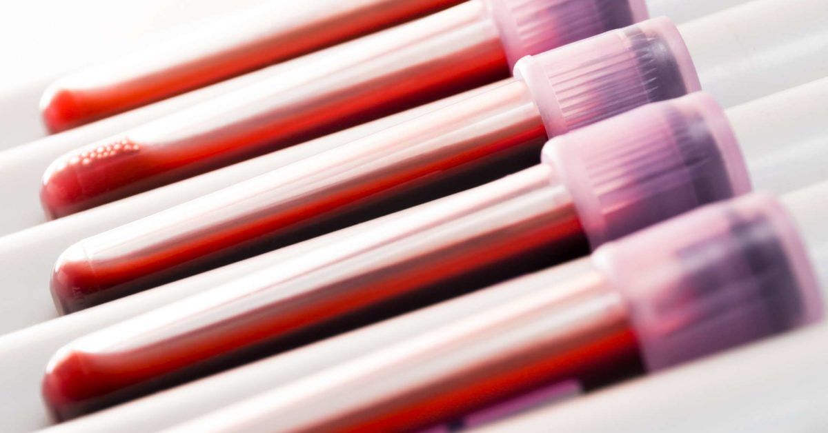 Epstein-Barr virus test: Procedure, results, and interpretation