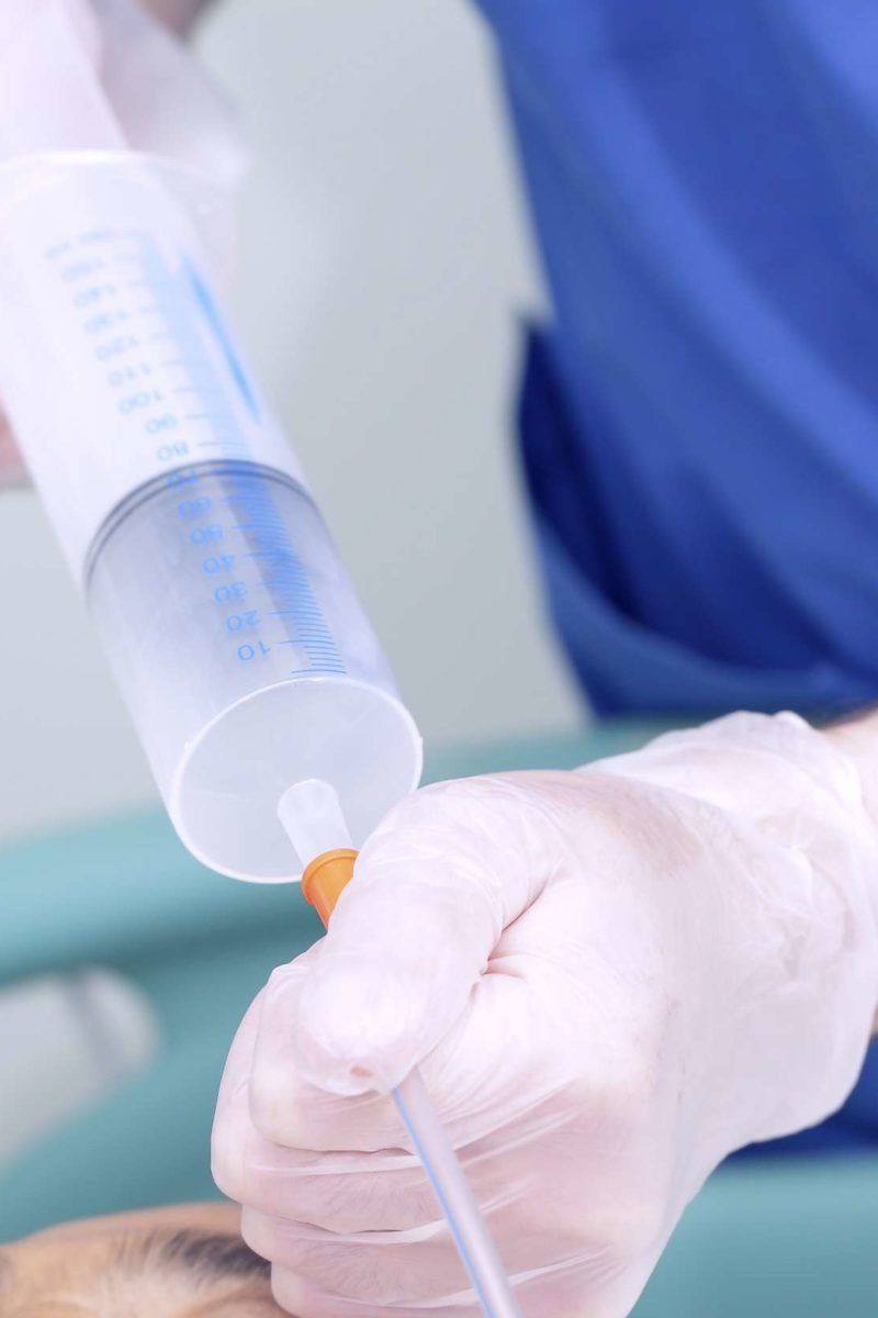 Refeeding syndrome: Causes, treatment, and prevention