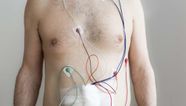 24 hour Holter Monitoring Uses Results And What To Expect