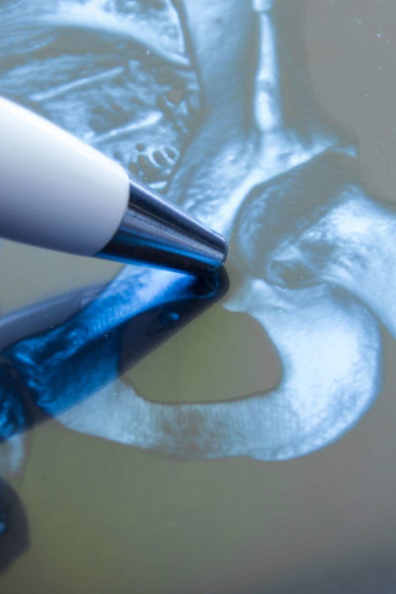 Toxic synovitis in children and adults: What to know