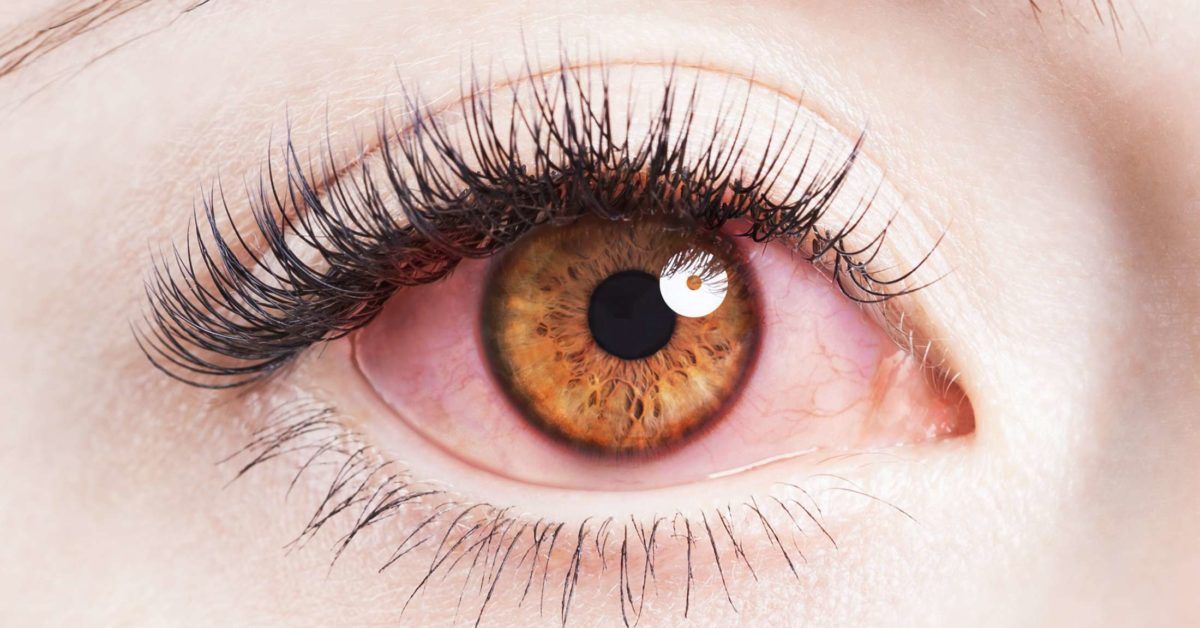 Persistent stress may lead to vision loss, study shows