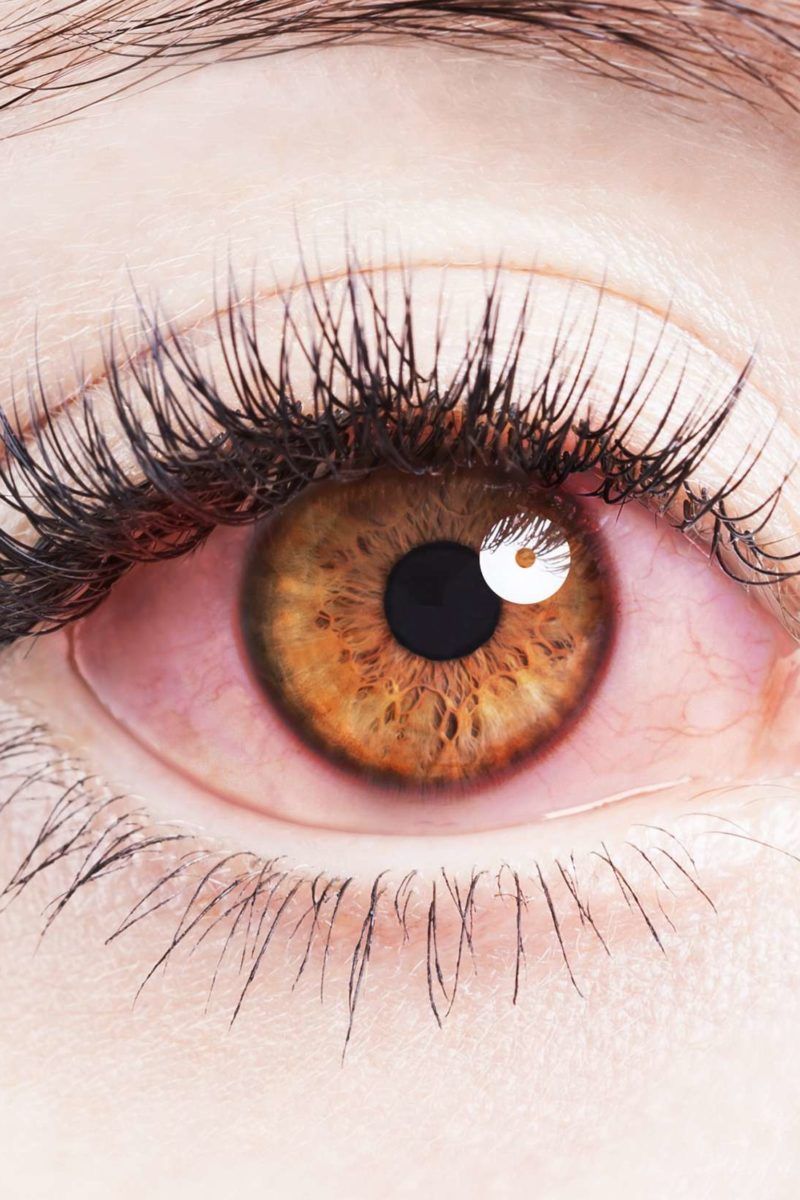 Persistent stress may lead to vision loss, study shows