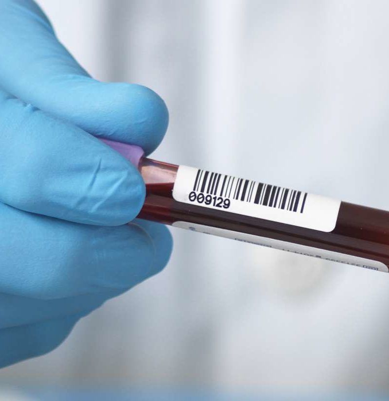 Anti-smooth muscle antibody test: Uses, procedure, and results