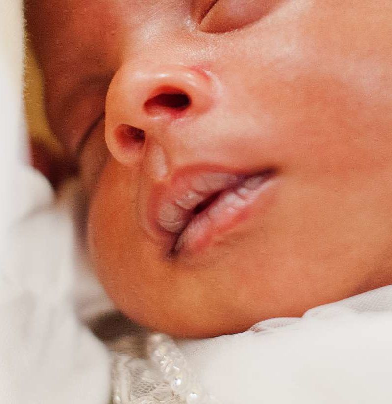 Newborn chapped lips: Treatment and causes