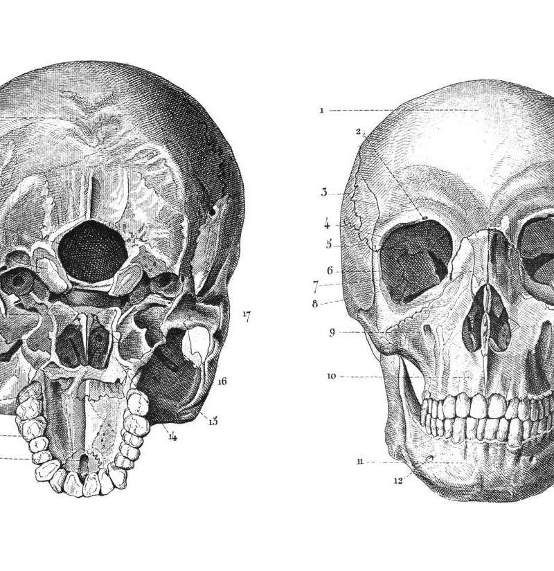 5 strange and sinister medical procedures from history