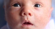 Little Red Spots On Baby S Lipstick Infoupdate Little Red Spots On Baby S Lipstick Infoupdate
