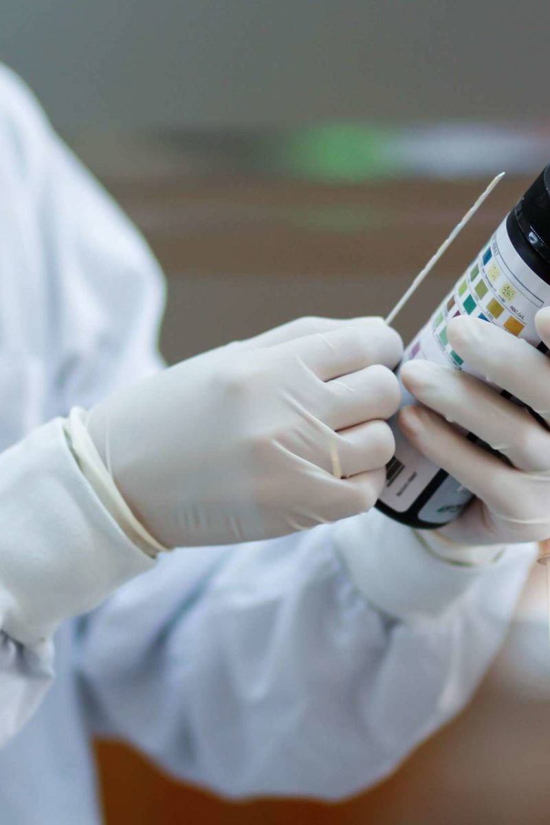 Urine pH: Normal ranges and what they mean