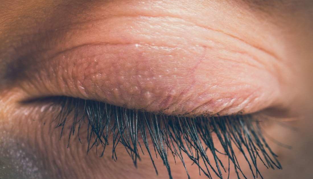 There's more to blinking than meets the eye