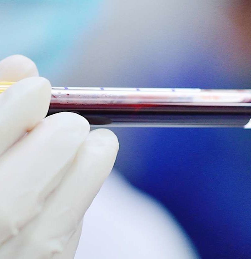 Luteinizing hormone (LH) test: Uses, ranges, and results