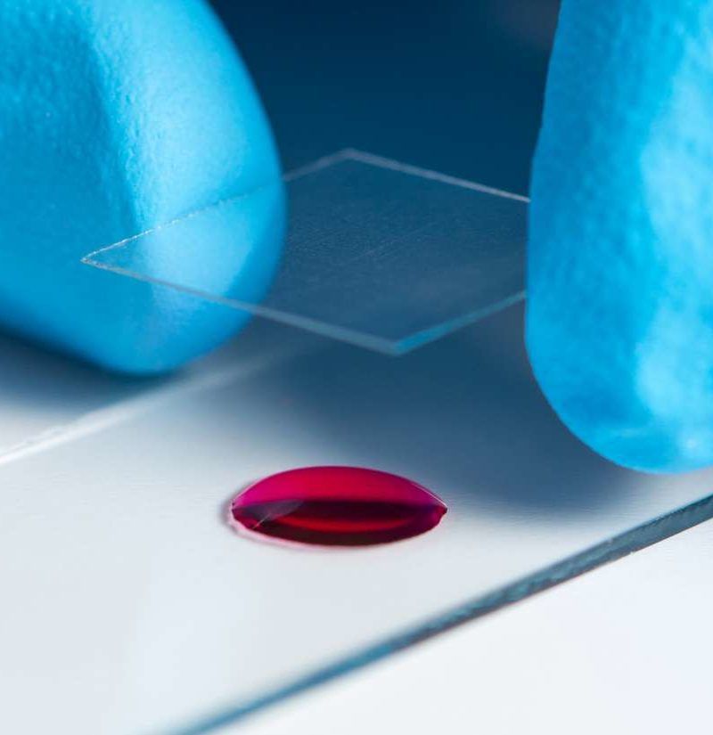 Alanine aminotransferase (ALT) test: Uses and results