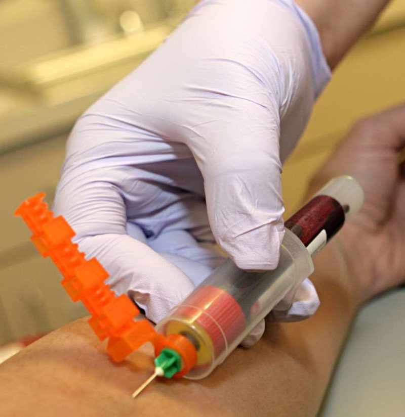 Amylase blood test: What to expect and what do the results mean?