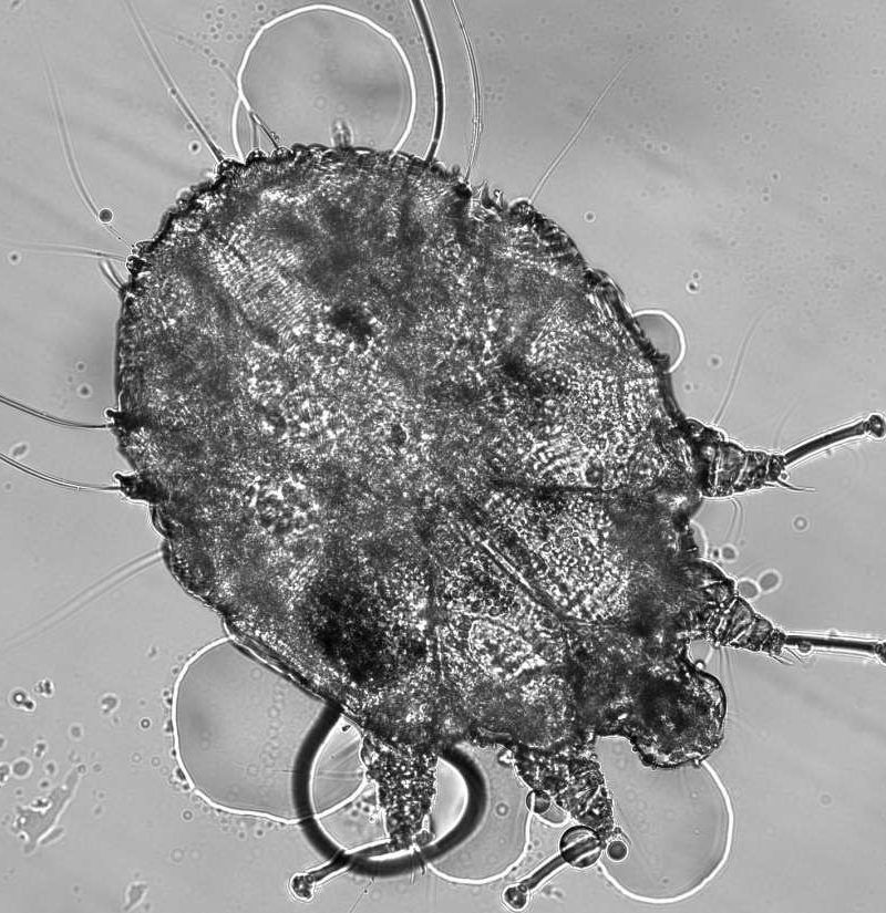 Scabies on the penis: Symptoms, treatment, and prevention