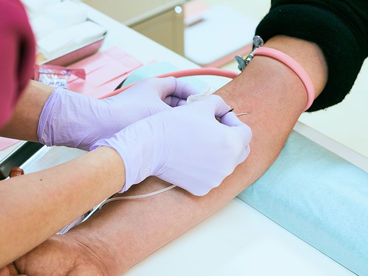 VDRL test: Purpose, procedure, and results