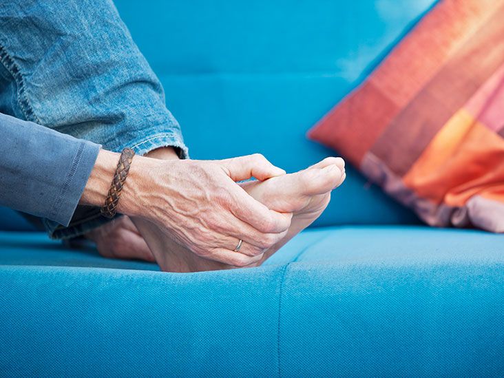 Hyperuricemia: Symptoms, causes, and treatment