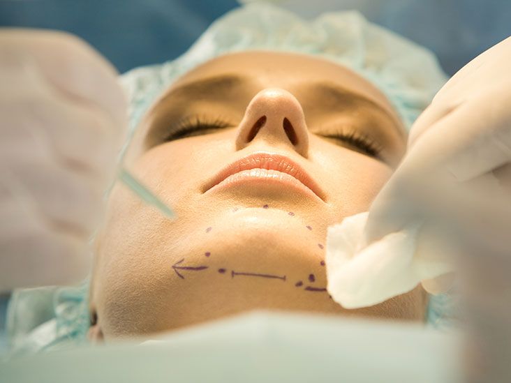 Genioplasty: Types, procedure, and recovery