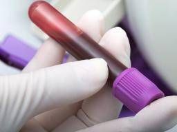 BUN levels: Measurements, results, and procedure