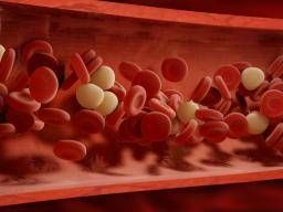Antiphospholipid syndrome: Symptoms, treatment, and diagnosis