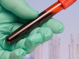 Sickle cell trait and disease: raising awareness