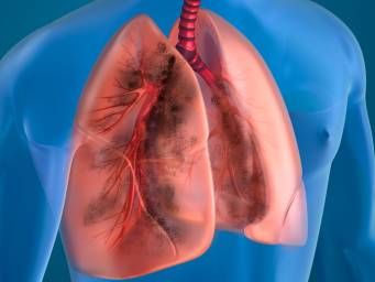 Bronchospasm: Causes, symptoms, and diagnosis