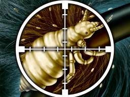 Lice Bites On Humans