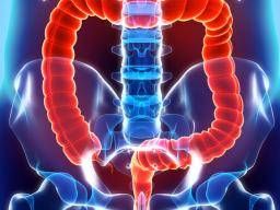 Pancolitis: causas, síntomas y tratamiento