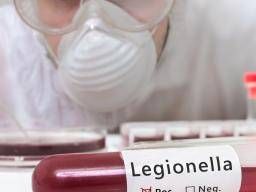 Legionnaires' disease: Symptoms, transmission, and causes