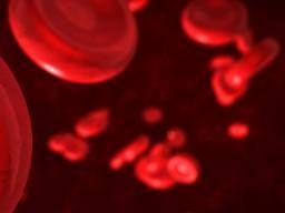 Microcytic anemia: Symptoms, types, and treatment
