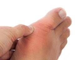Gout flare-ups could be managed by blood pressure diet
