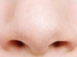 Deviated septum: Causes, symptoms, and treatment