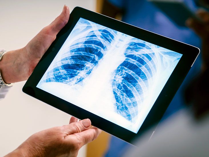 How many ribs do humans have? Men, women, and anatomy