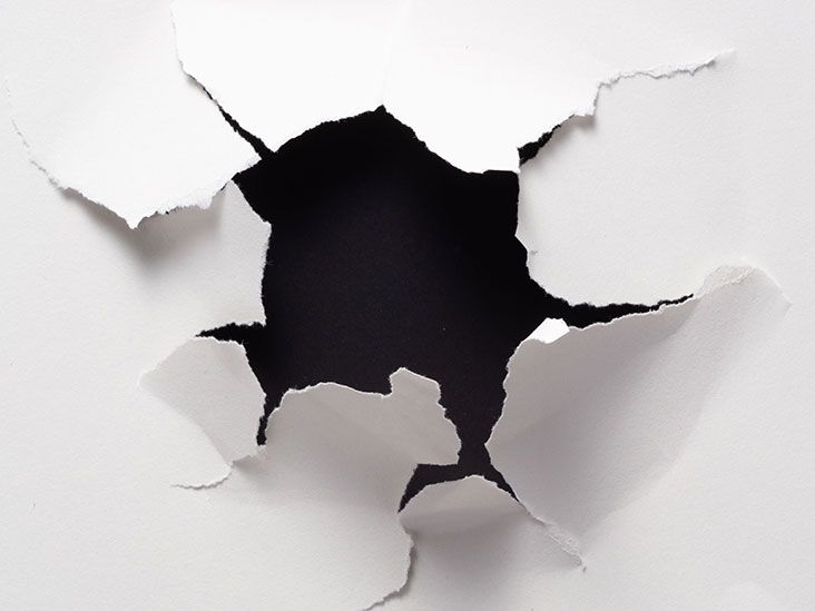 What is white fragility, and why is it a problem?