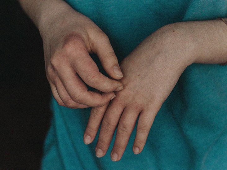 How do you get scabies? Causes, prevention, and treatment