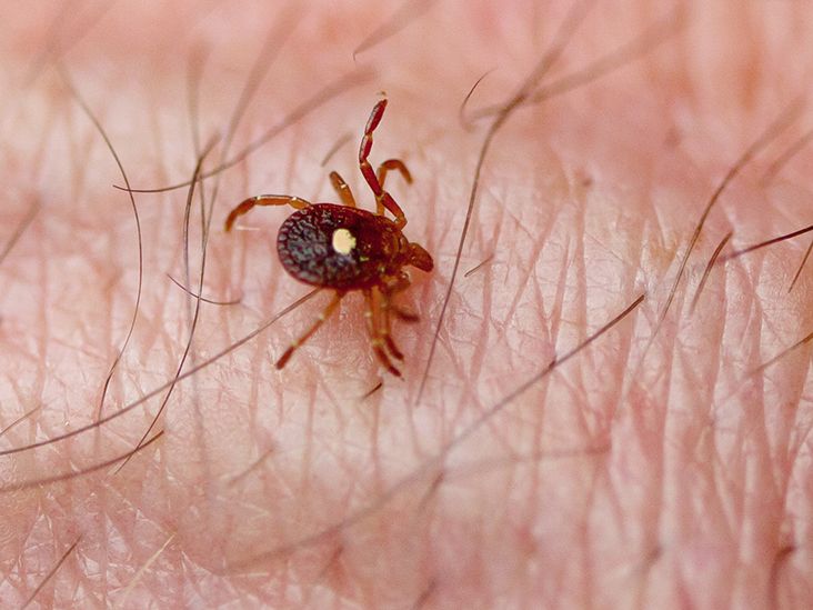 Ehrlichiosis: Definition, symptoms, and treatment