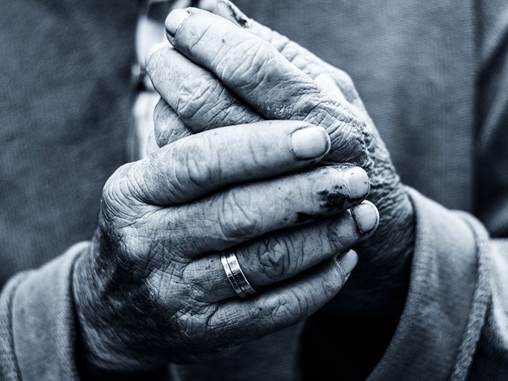 Wrinkles: Causes, treatment, and prevention