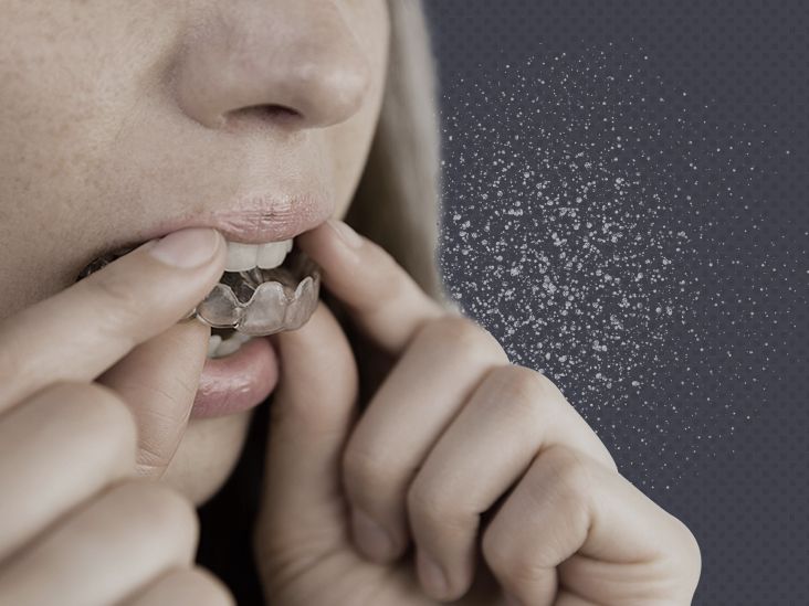 Mouth guard for grinding teeth: Options and when to see a dentist