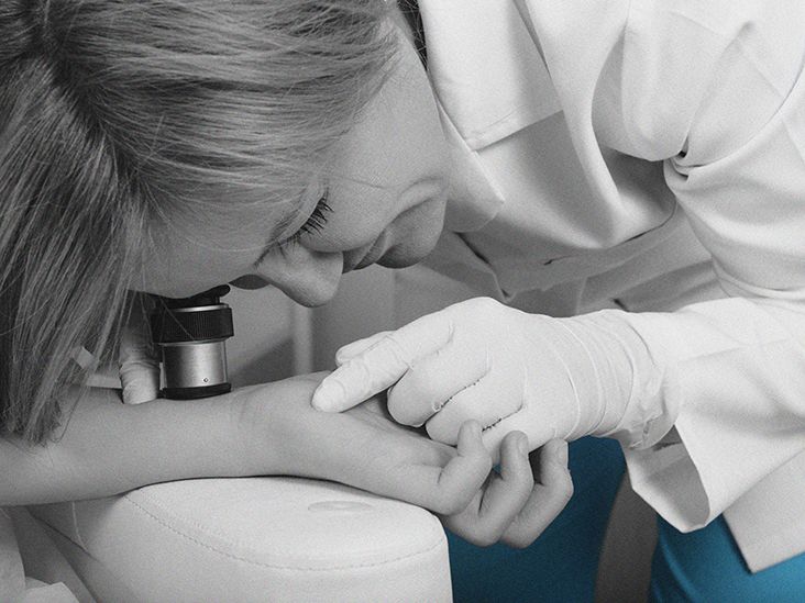 List of rare skin diseases: Pictures, symptoms, and treatments