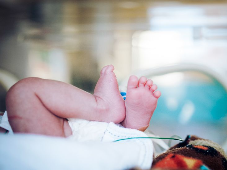 What is aplasia, and where can it occur?