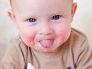 Can Teething Cause White Spots In Mouth Infoupdate