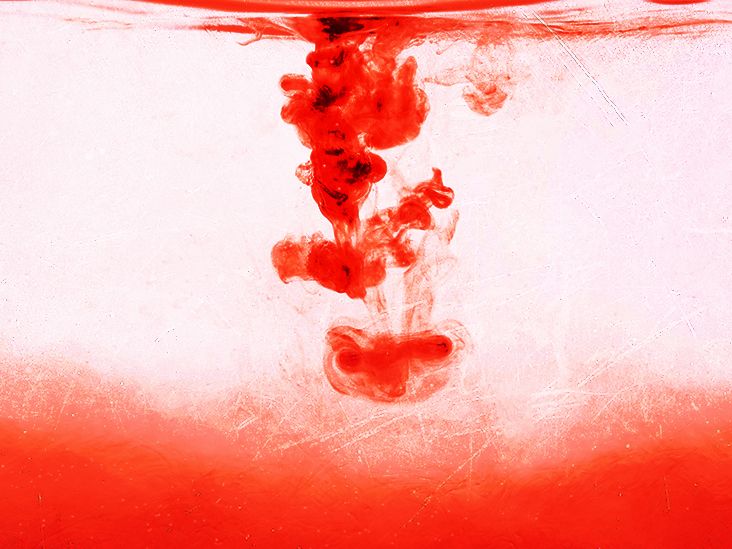Sickle cell anemia: Symptoms, treatment, and causes