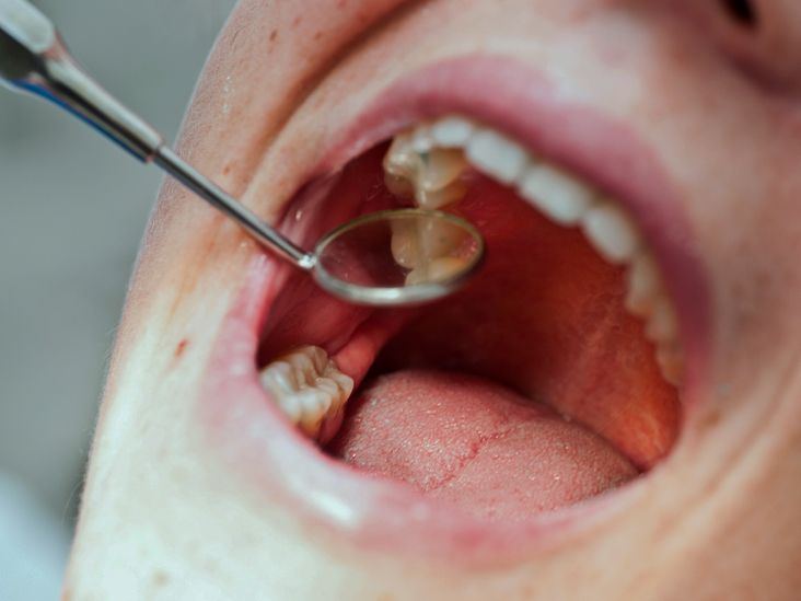 Hypoplasia: Where it can occur, causes, effects, and treatment options